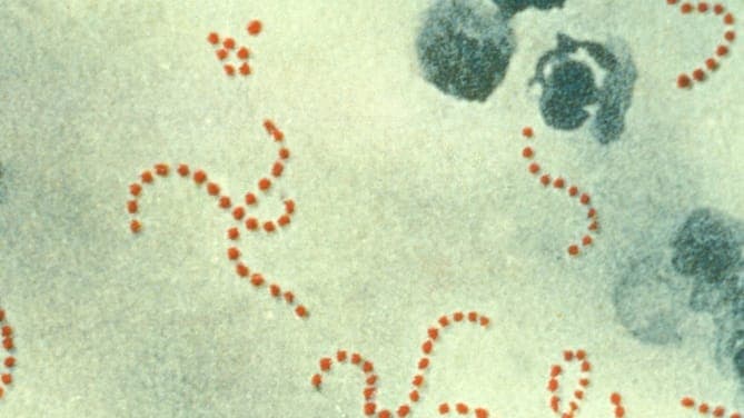 Health leaders issue advice for parents on Strep A and Scarlet Fever ...