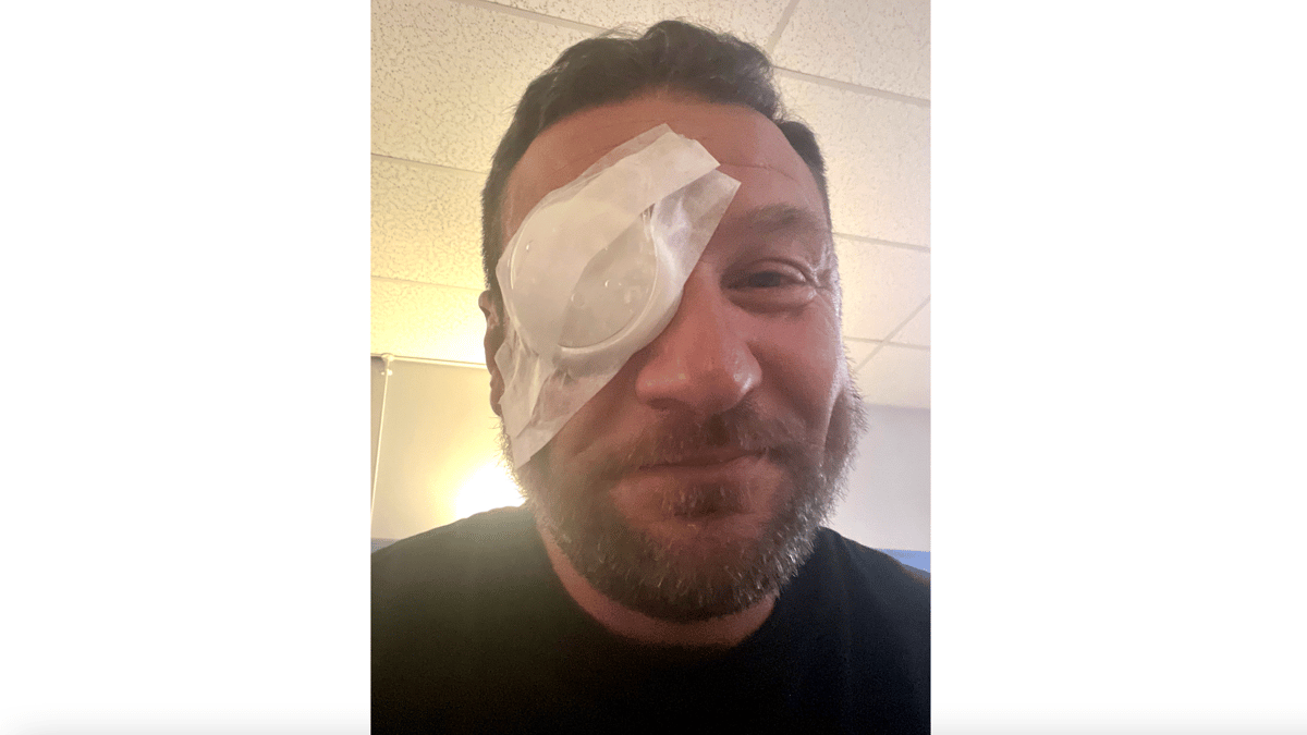 Golfer blinded in one eye by wayward shot | theforester.co.uk